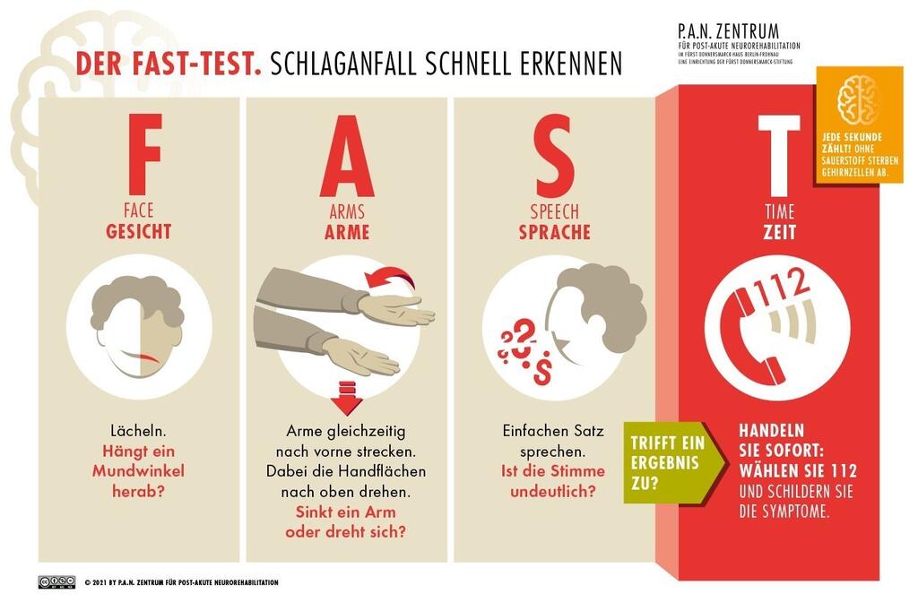 Wie erkenne ich einen Schlaganfall?: Fürst Donnersmarck-Stiftung zu Berlin